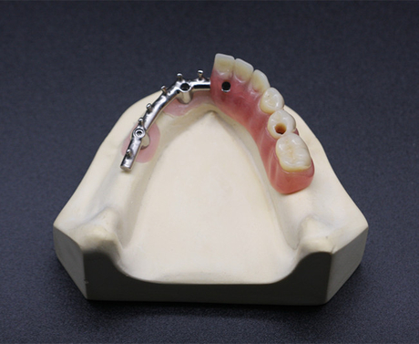 Implant Bar - China Dental Laboratory (CDL) Co., Ltd